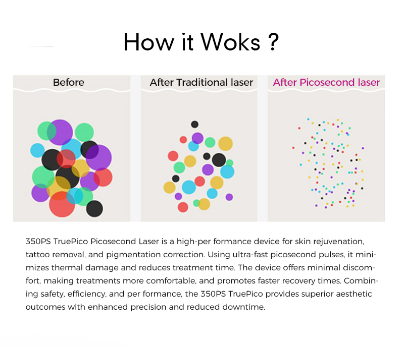 350PS Real Pico Laser Machine - Buy pico laser machine, pico laser ...