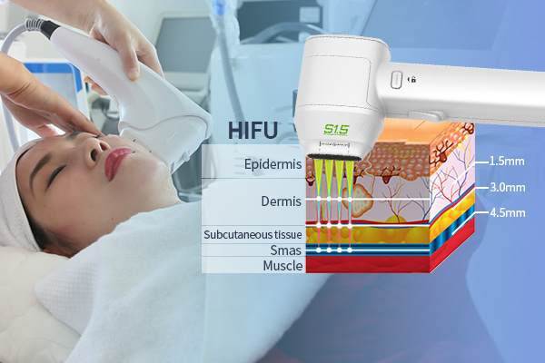 hifu machine for sale FU4-1S - Beauty Machine Supplier and Manufacturer ...